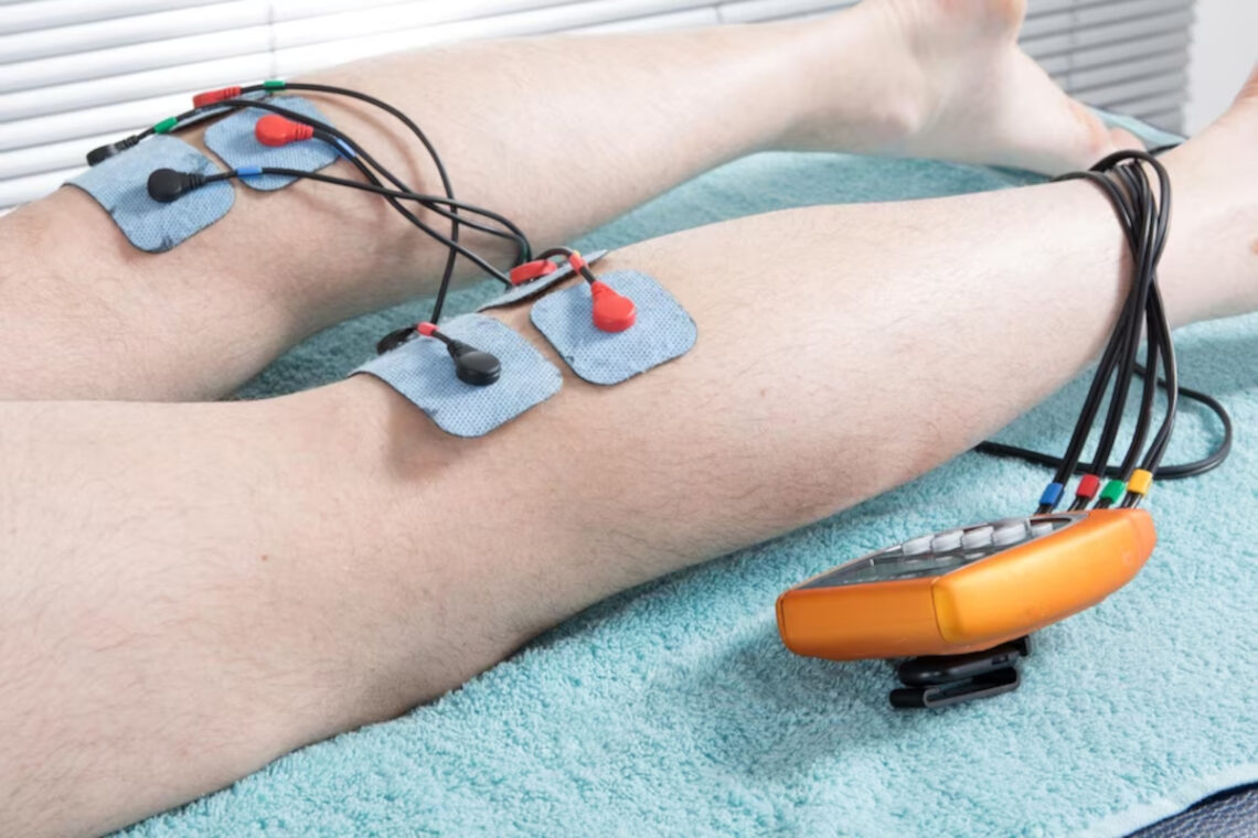Comment l'électrostimulation musculaire stimule la contraction des muscles